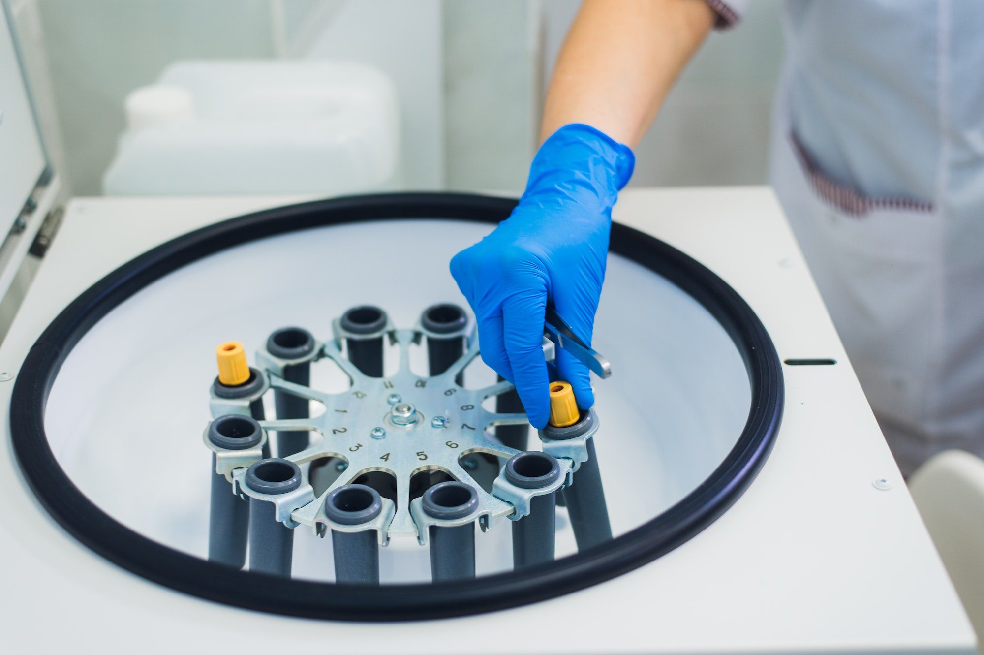 PRP / PRF / Bio Filler Therapy | Arria MedSpa NJ