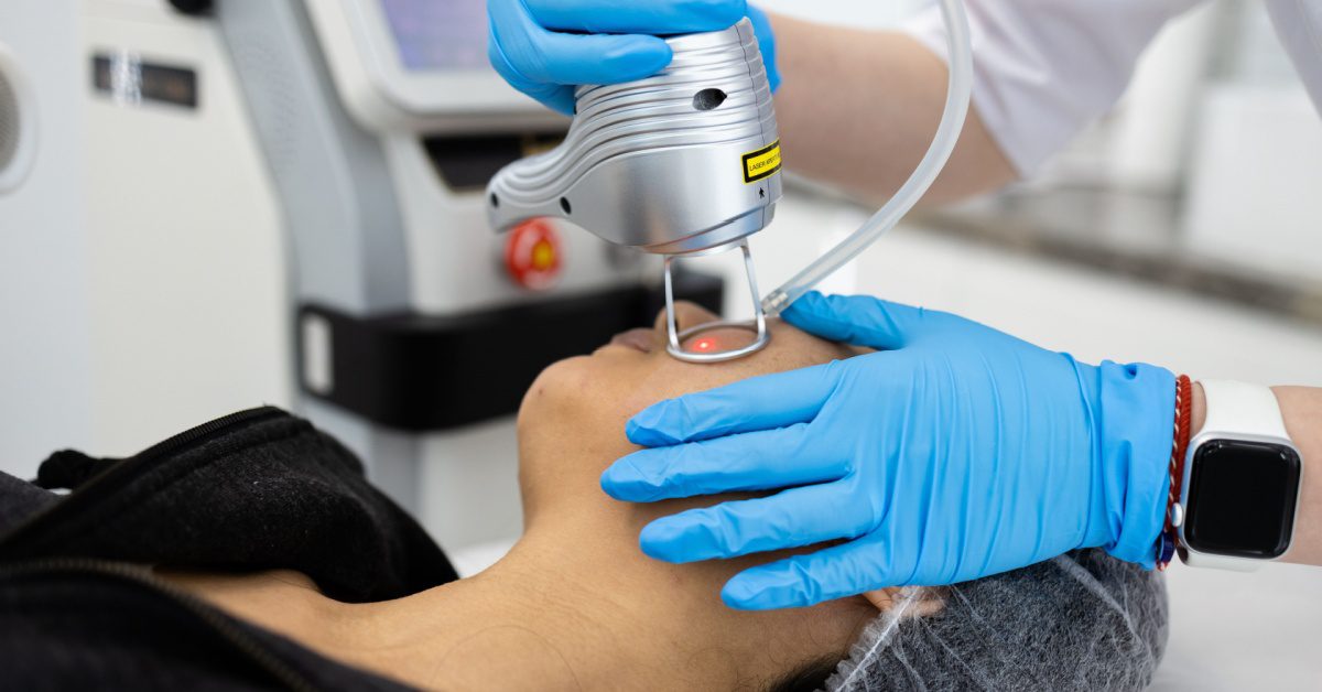 3 Types Of Laser Treatments For A Youthful Appearance